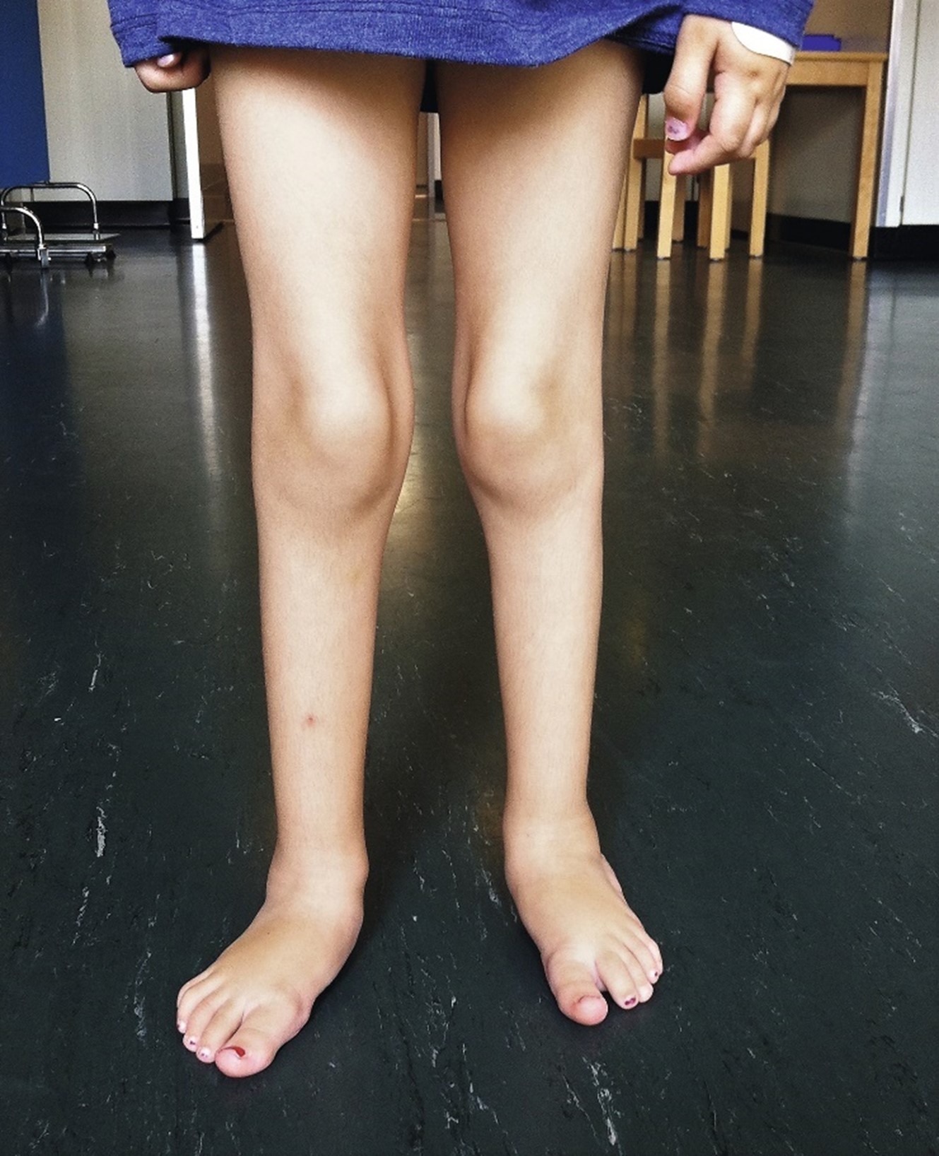 Sport bei Kindern und Jugendlichen mit rheumatischer Erkrankung ...