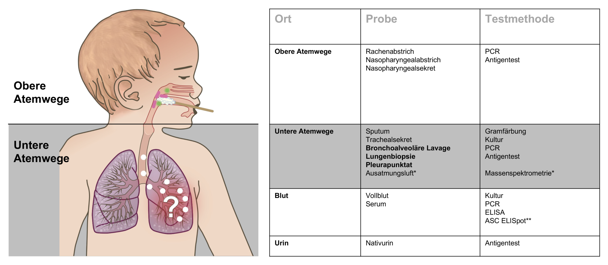 Diagnose und Therapie der Pneumonie bei Kindern und Jugendlichen ...