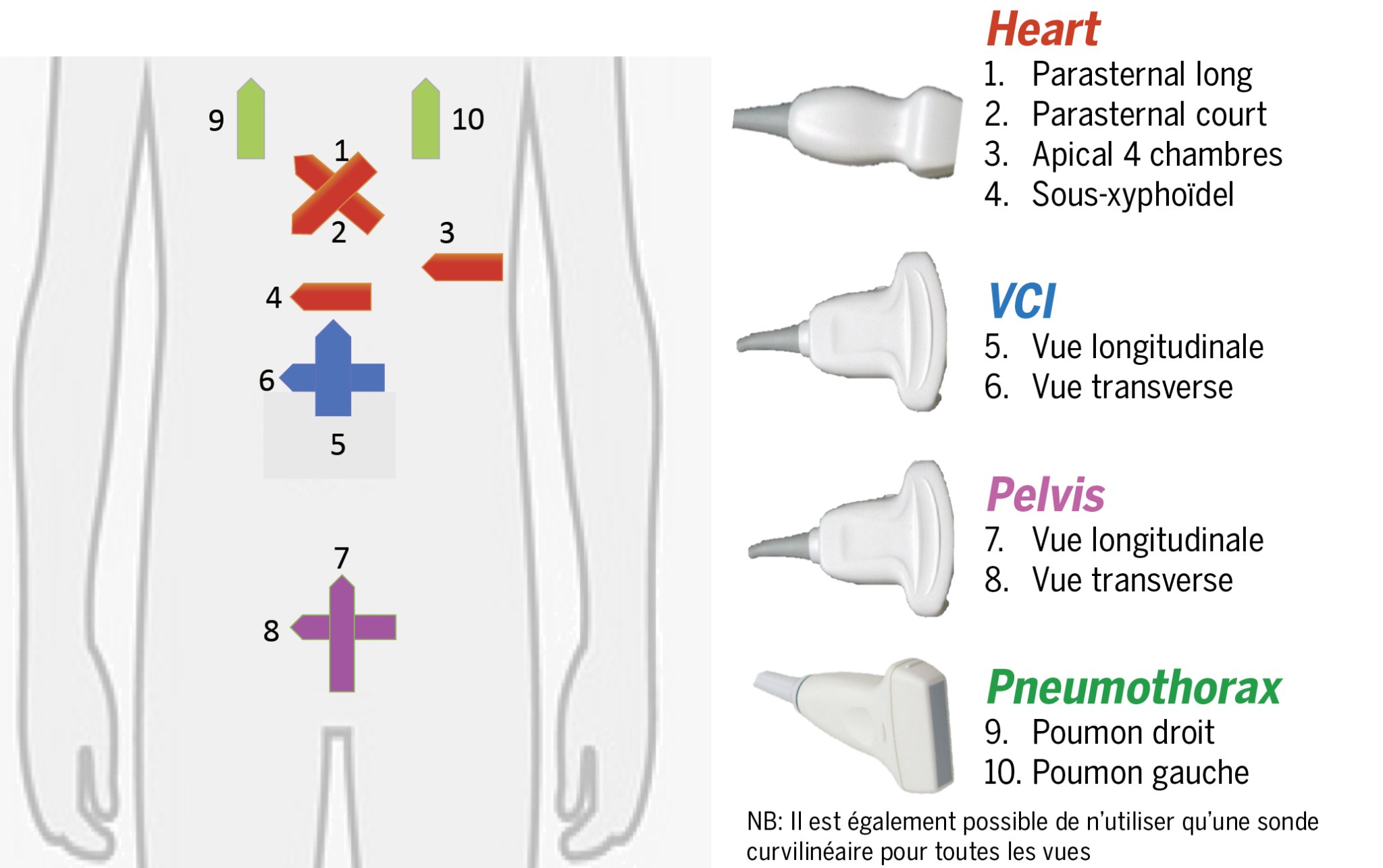 Utilité du POCUS pour évaluer l’état de choc en pédiatrie - pädiatrie ...