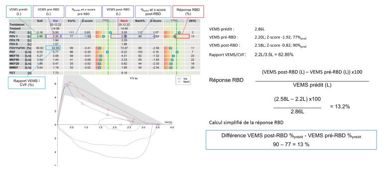 Recommandations suisses pour le diagnostic, le traitement et la prise en charge de l’asthme de l ...