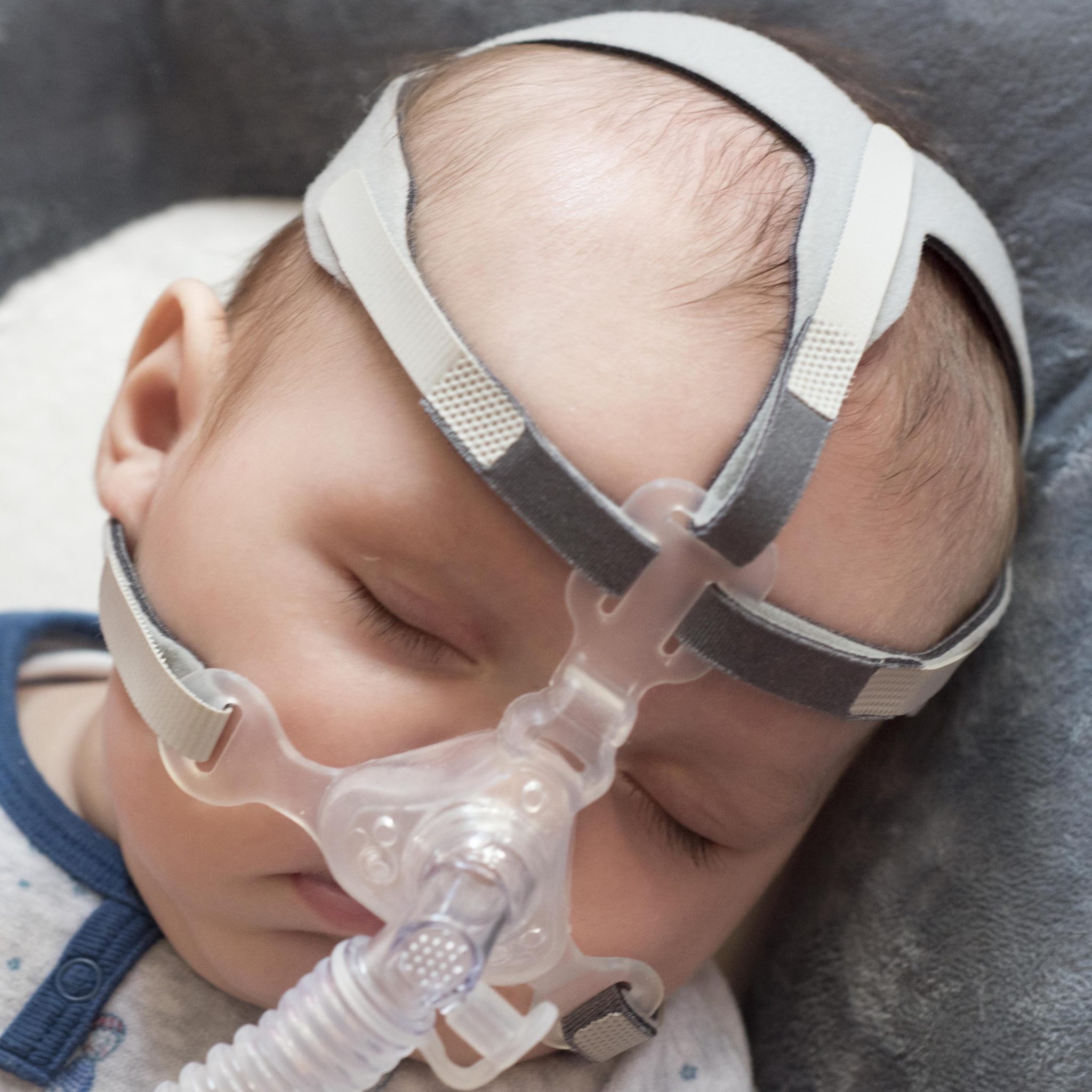 Die nicht-invasive mechanische Atemunterstützung bei Kindern im ...