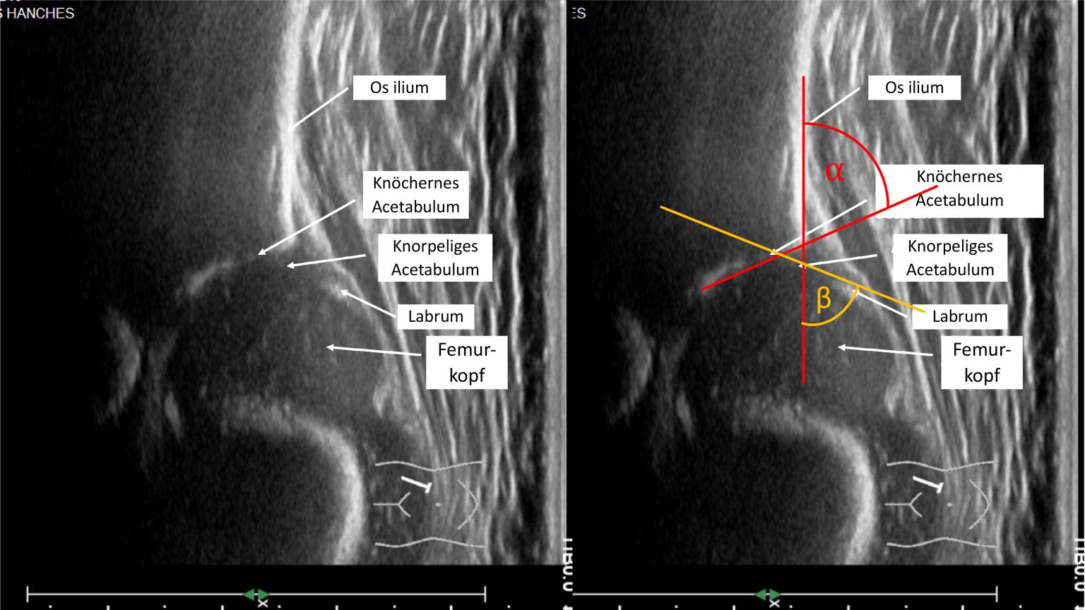 Die klinische Untersuchung von Neugeborenen und die regionalen ...